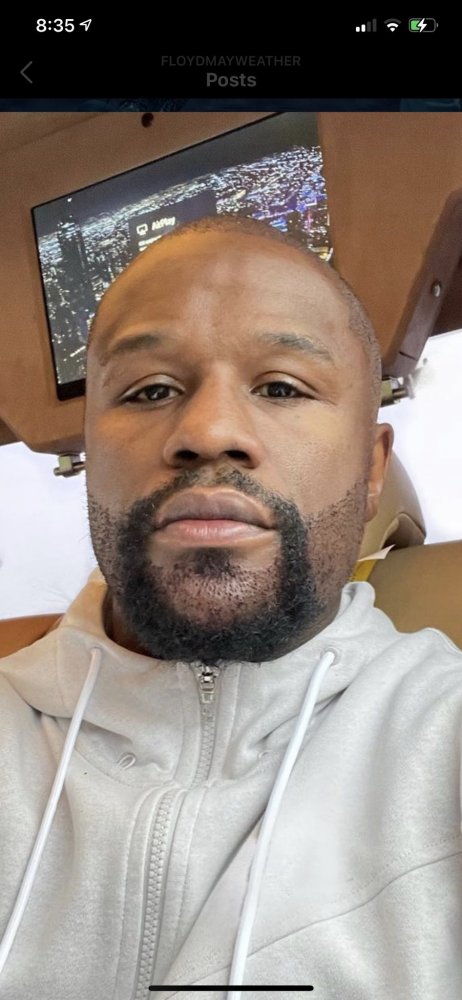 Floyd Mayweathers Beard Transplant with Dr. Acar, Cosmedica Clinic ...