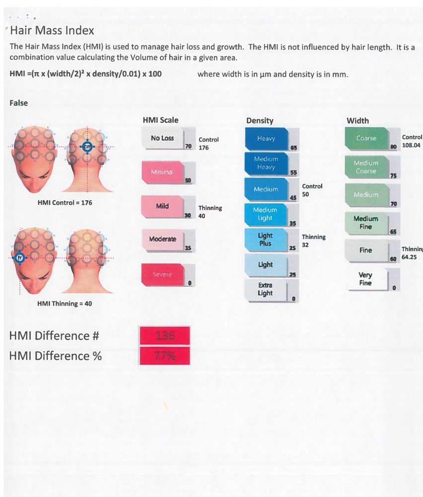 Scalp & Hair Diagnostic Report - July 2020 | Hair loss Forum - Hair ...
